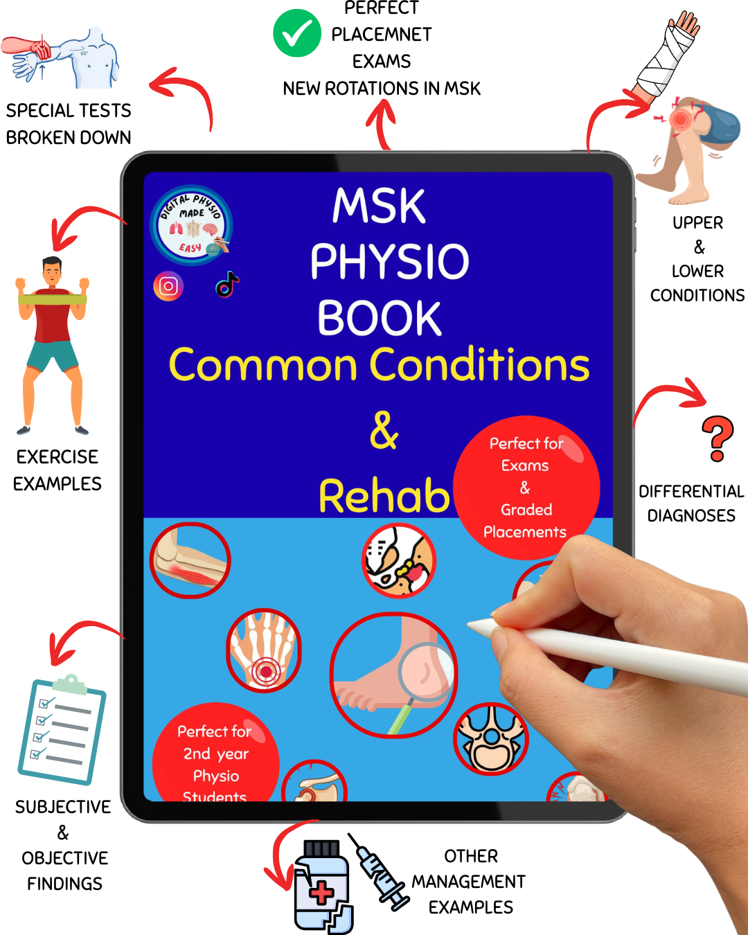Digital-MSK physio 2nd year notes – Digitalphysiomadeeasy
